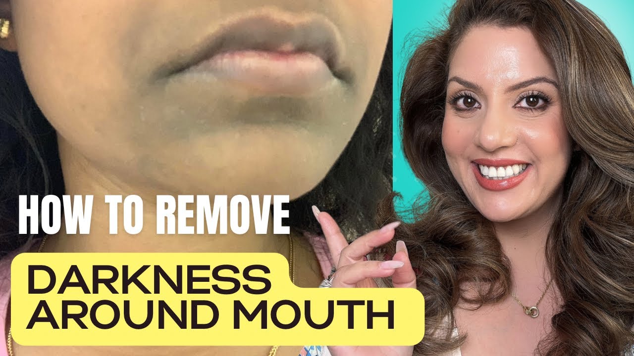 How To Remove Darkness Around Mouth Naturally Easy Home Remedies For how-to-remove-darkness-around-mouth-naturally-easy-home-remedies-for