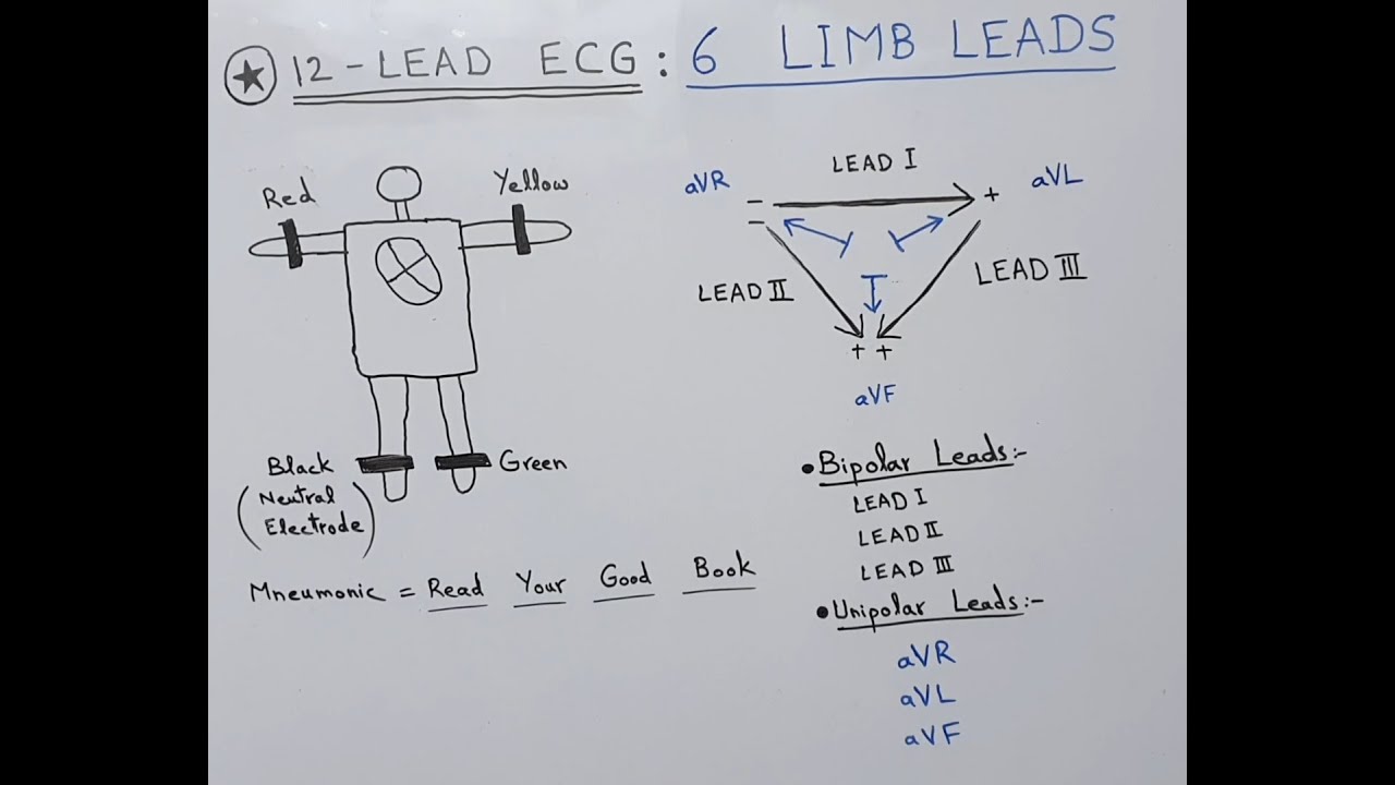 ECG Basics - 12-Lead ECG | Leads and Electrodes | Limb and Chest ...