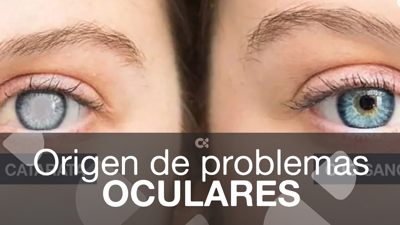El 20% de los problemas oculares que se produce en verano tiene que ver ...