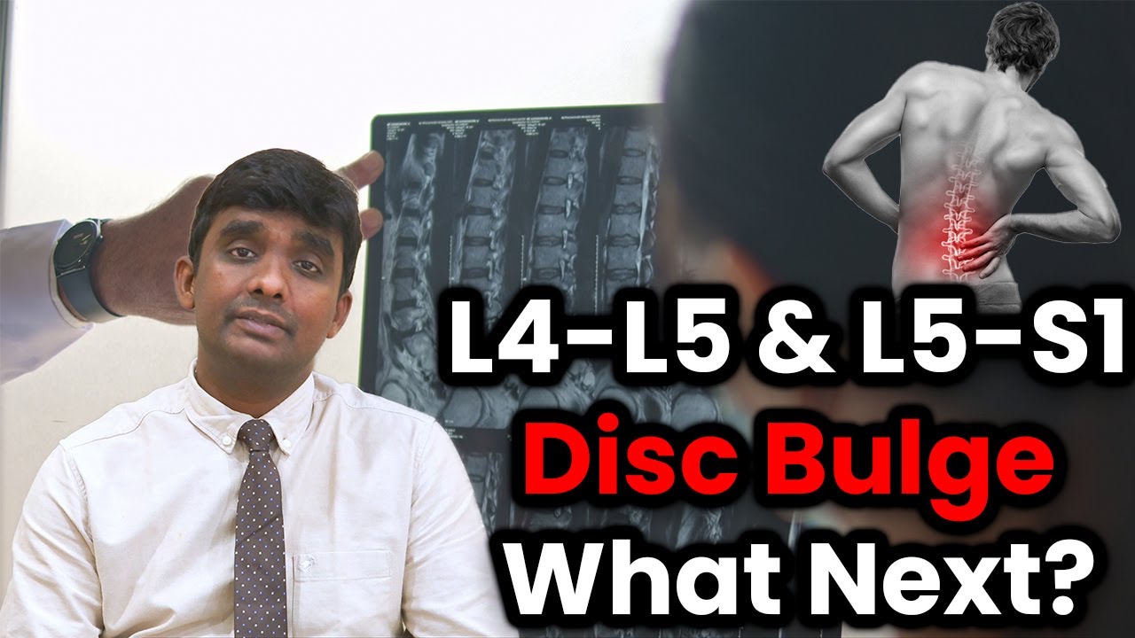 Unlocking a Pain-Free Future: L4-L5 & L5-S1 Disc Bulge What Next? 🚀 ...