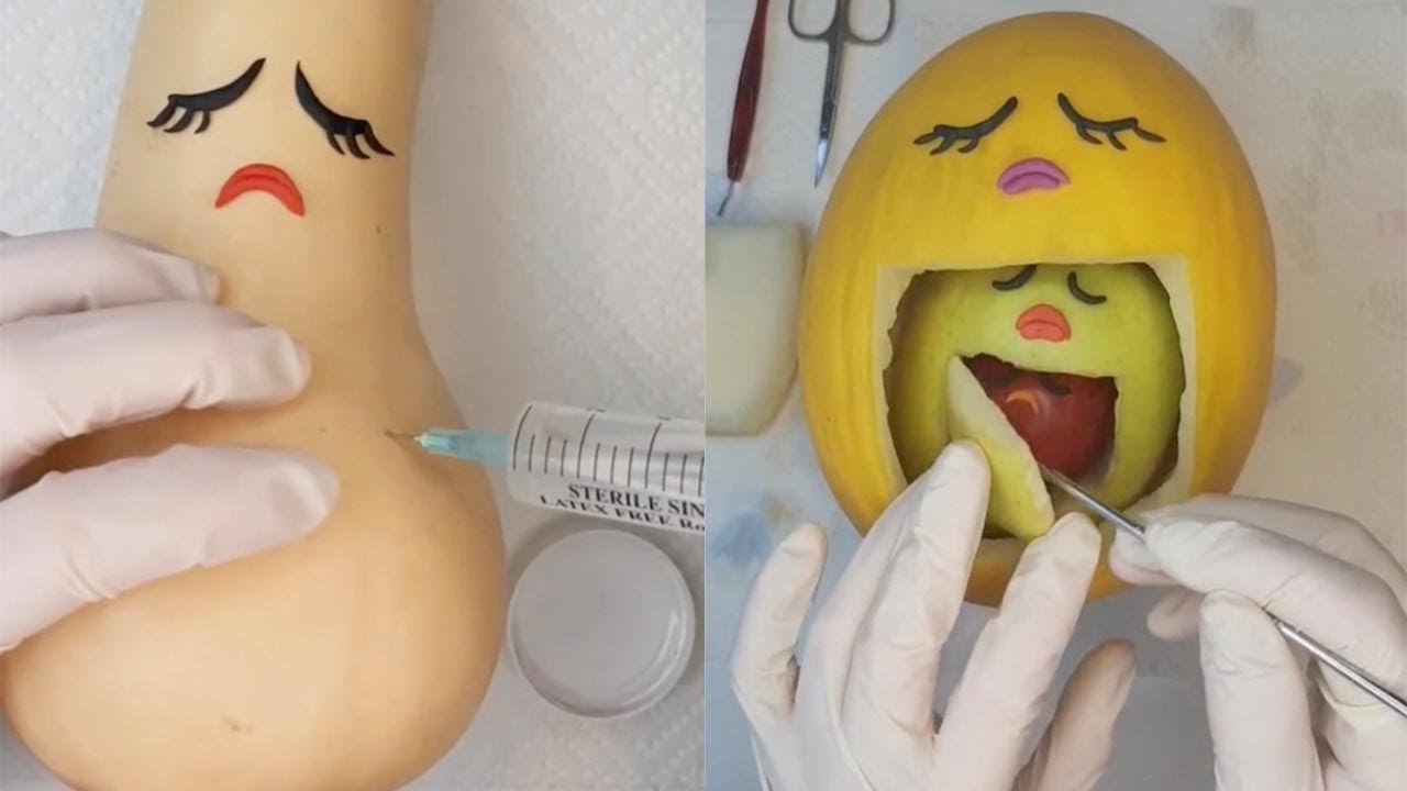Man Performs Surgery On Food In Hilarious Videos - YouTube