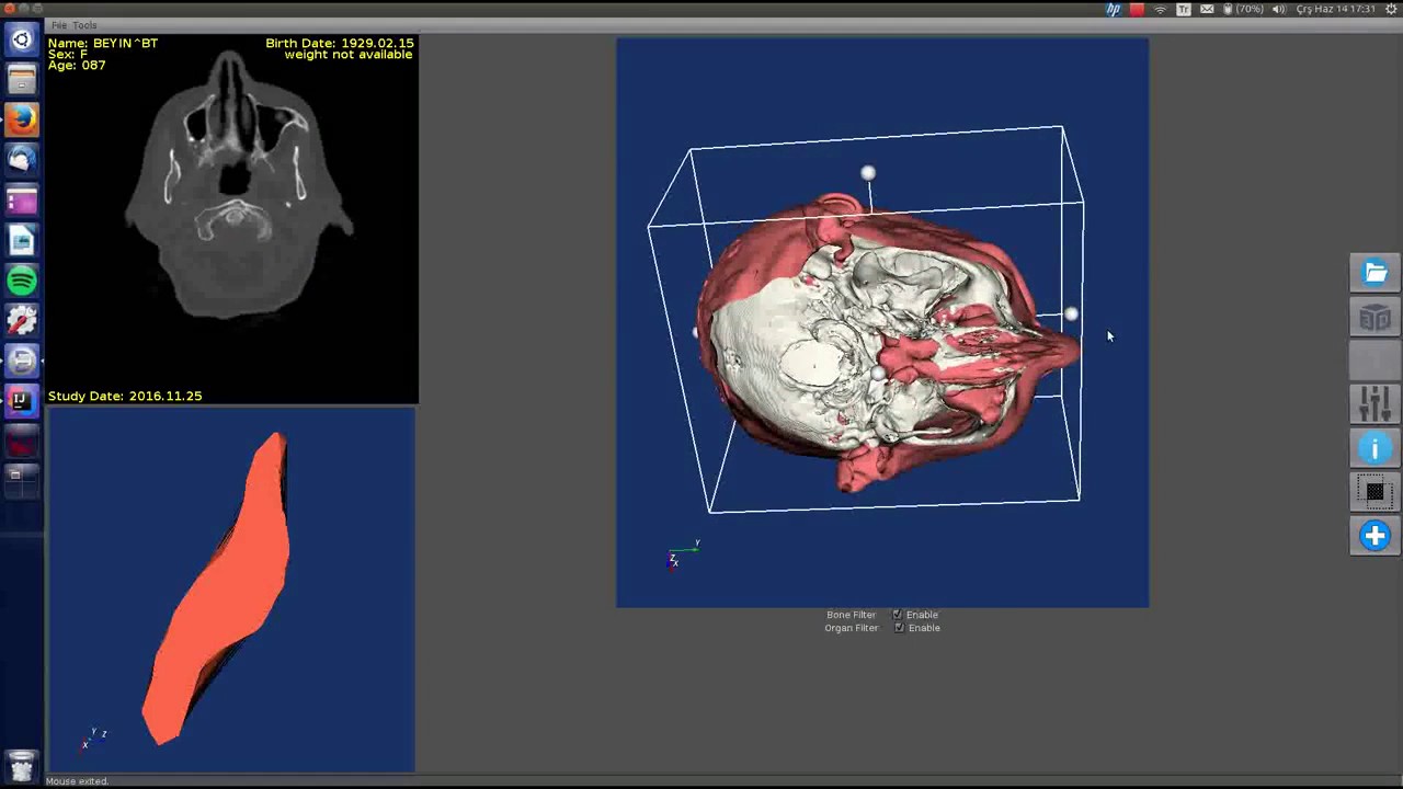 CT Scan Viewer - YouTube