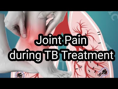 Leg pain during TB treatment| Joint pain during TB treatment| Colours ...