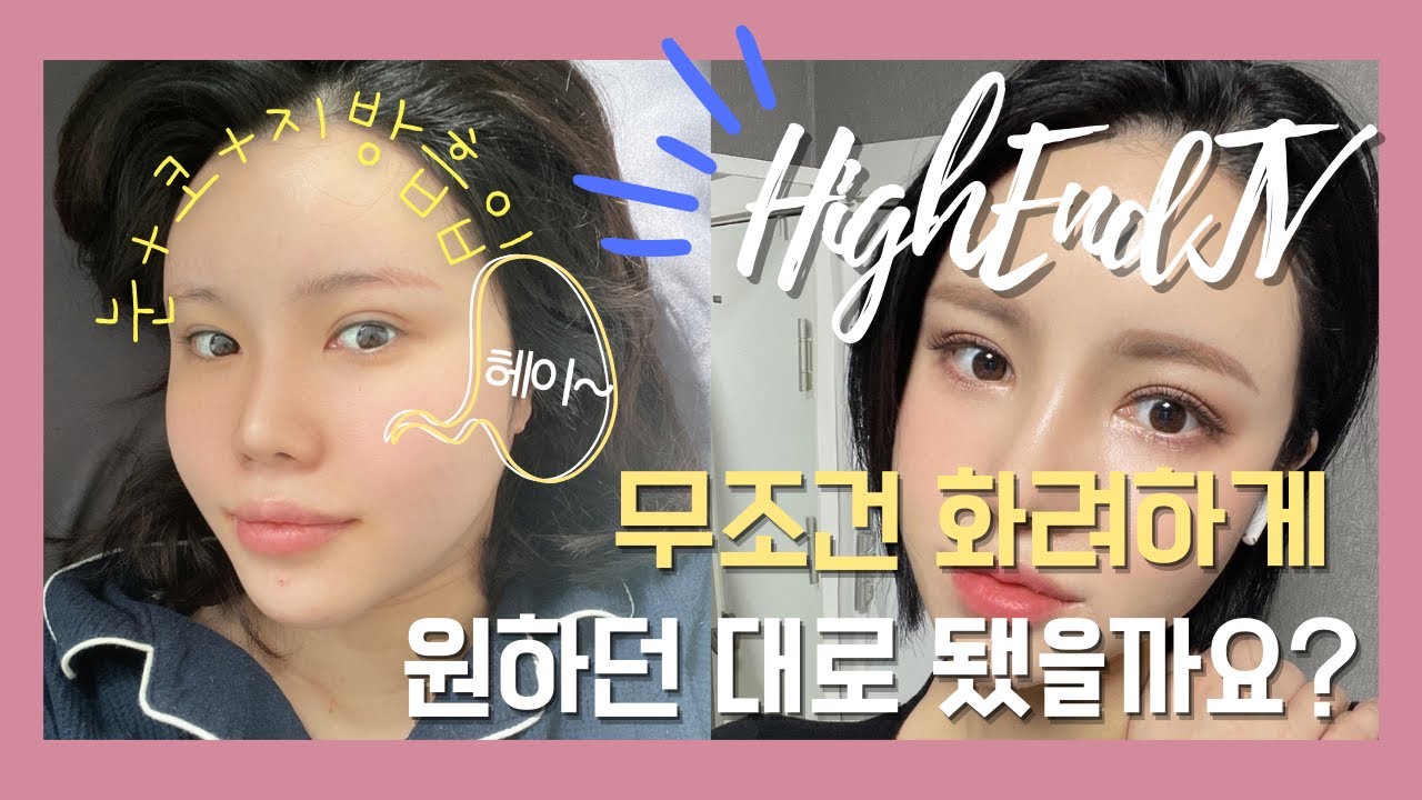 성형 브이로그 자가늑연골 코재수술 화려한코성형 그녀는 성공했을까👀 절개 쌍수 붓기 실화냐 말도 안되는 그녀의 변신🤍