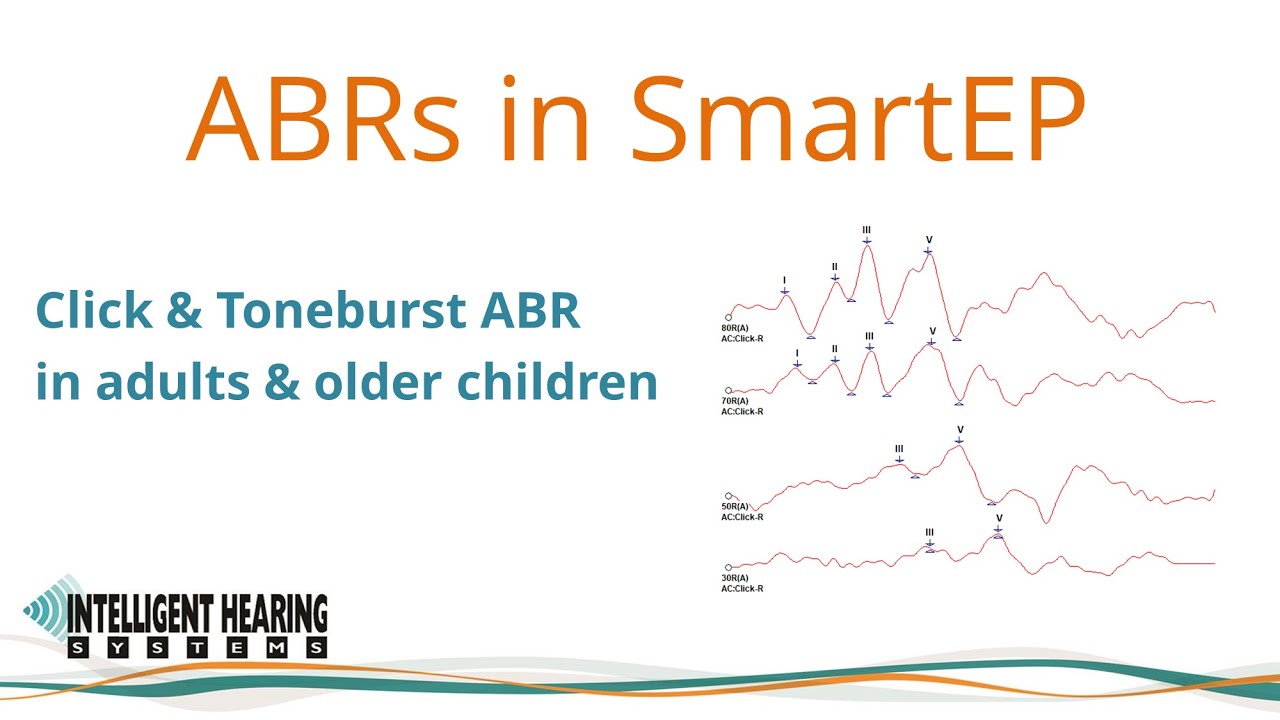 Adult ABR Training - Acquiring Click and Tone Burst ABR using SmartEP ...