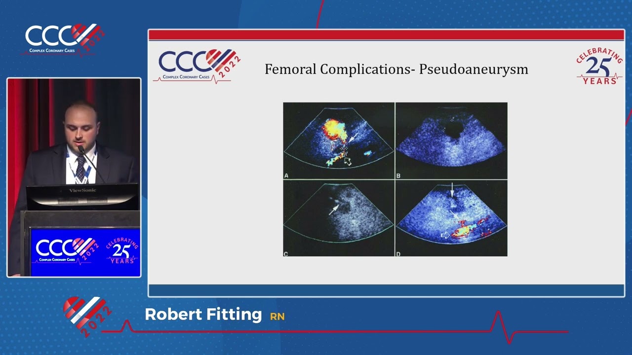 Femoral or Radial Approach and Impact on Vascular Complications ...
