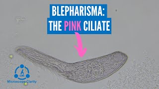 Blepharisma 100x
