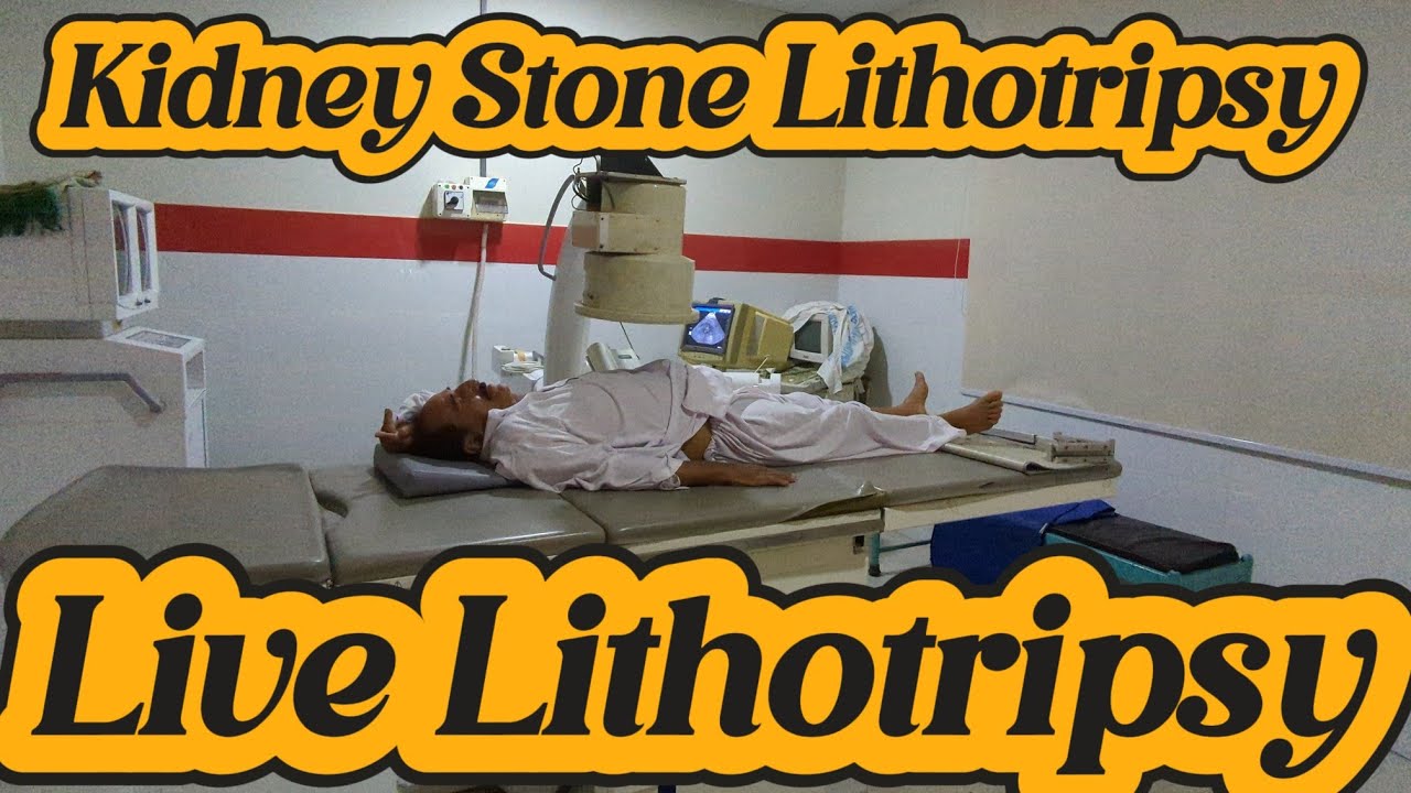 How do ESWL Lithotripsy Work | Extracorporeal Shock Wave Lithotripsy ...