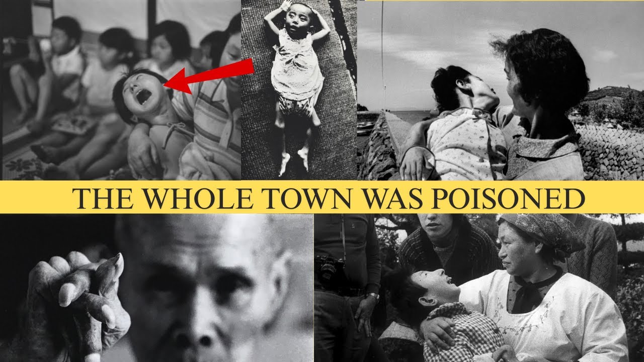 Minamata Mercury Disaster and the 'Dancing Cat Disease¨ of Japan - YouTube