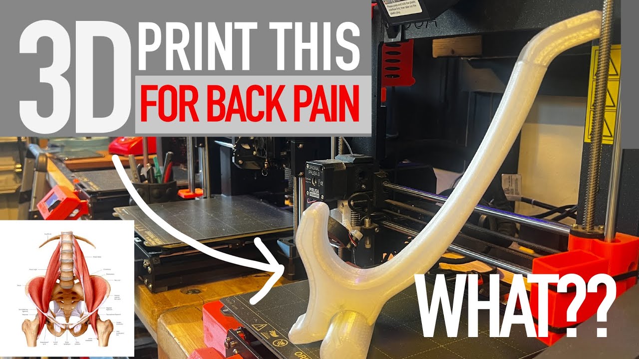How 3D Printing removed my back pain - YouTube