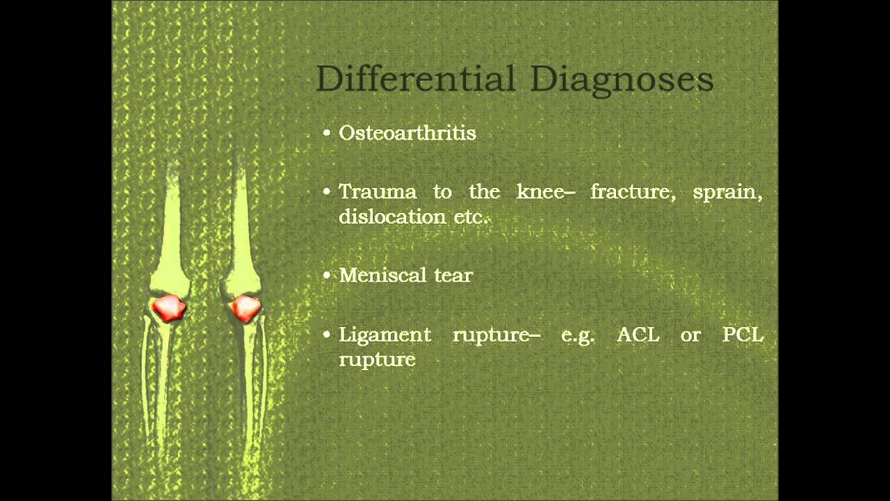 USMLE Step 2 CS : Knee Pain - YouTube