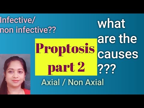 Classification and causes of Proptosis // Axial or non axial proptosis ...