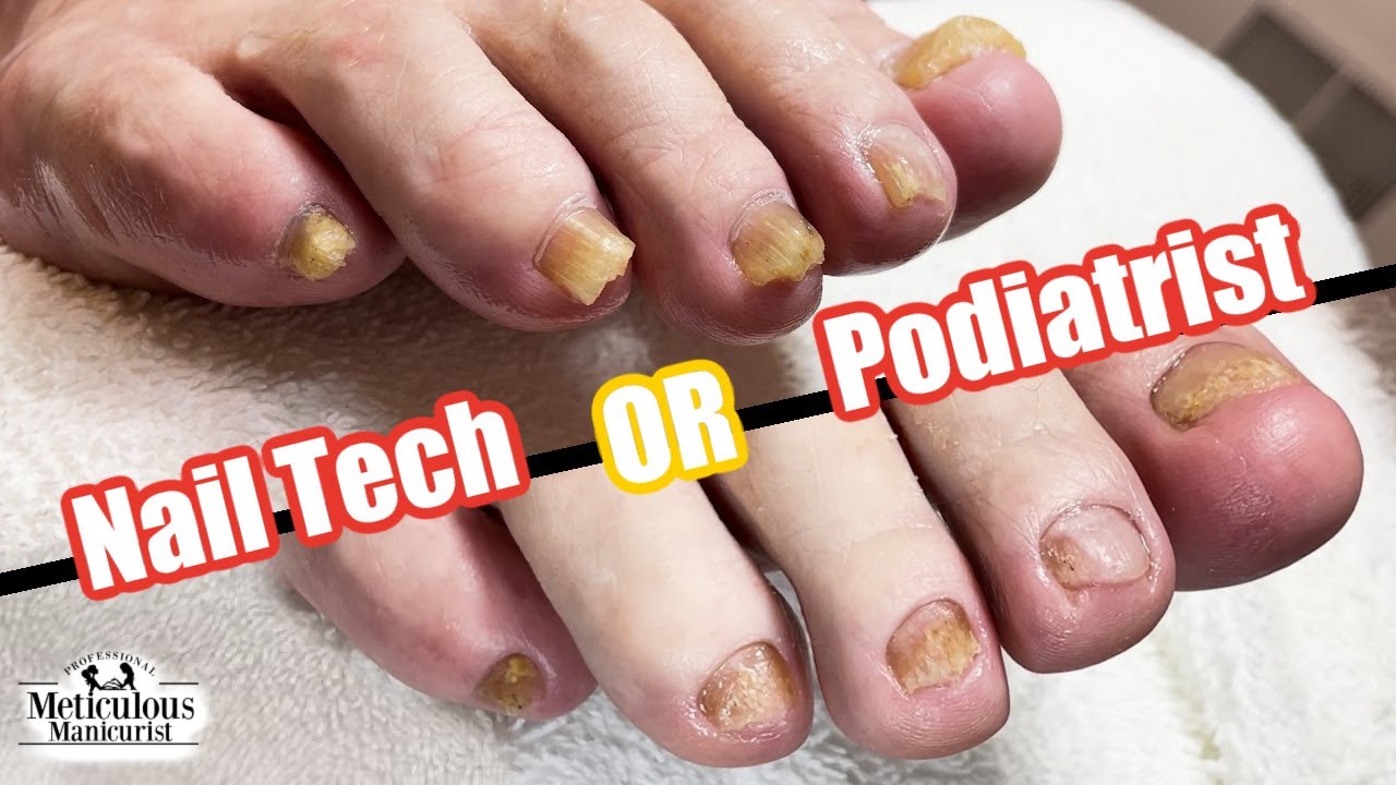 Nail Technician or Podiatrist: A Comparison in Feet and Foot Care ...
