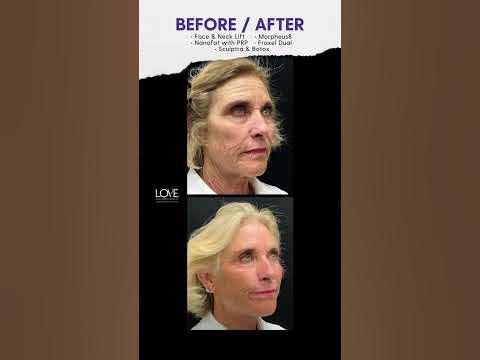 The Power of Combining Procedures - YouTube