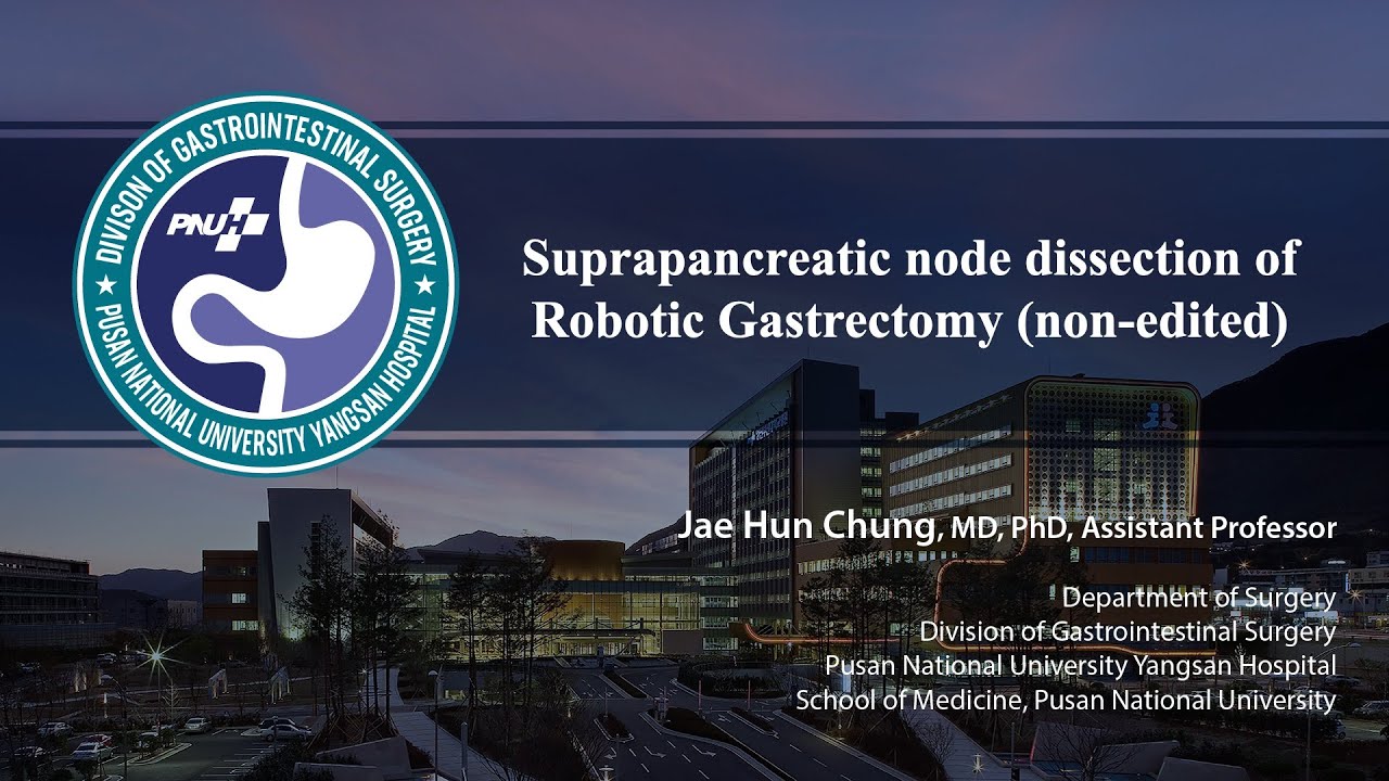 Suprapancreatic lymph node D2 dissection in robotic gastrectomy for ...