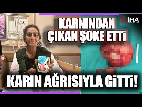 Karın Ağrısıyla Gittiği Hastanede Karnından 6 Kiloluk Kitle Çıkartıldı