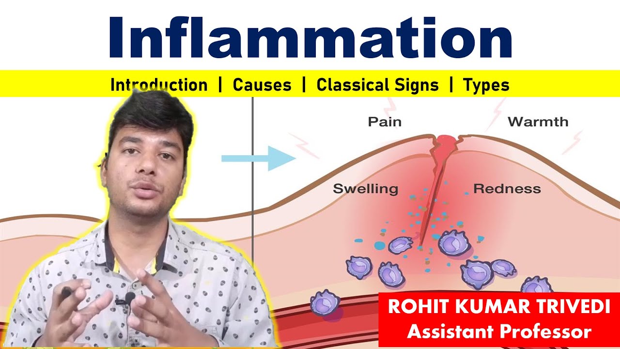 Inflammation | Cardinal Signs of Inflammation | Types of Inflammation ...