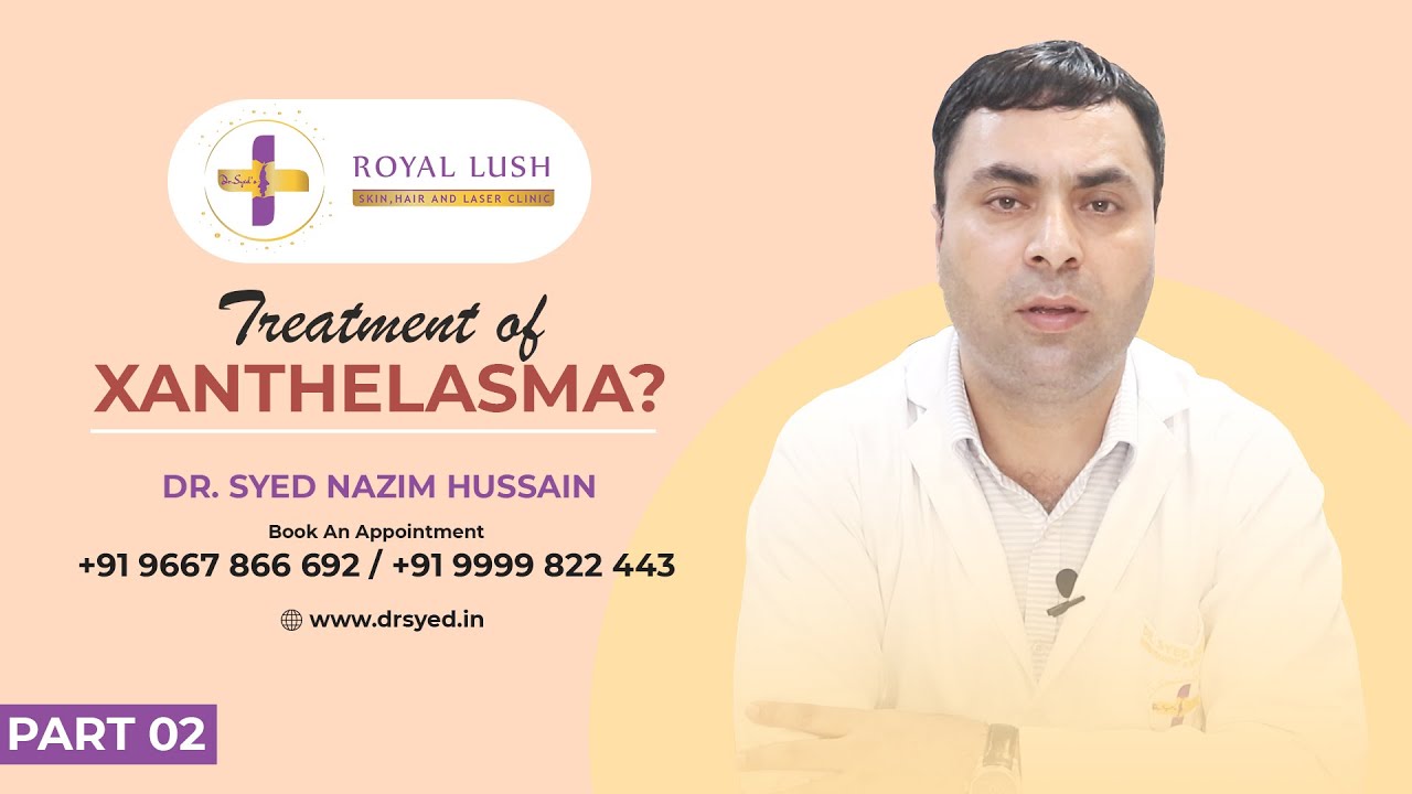 Xanthelasma Treatment In South Delhi By Dr. Syed Nazim | Royal Lush ...
