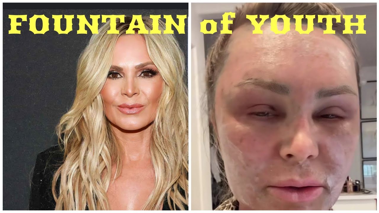 Tamra Judge's Bold Move|Brow Lift & Laser at 56! Is Staying Young BY ...