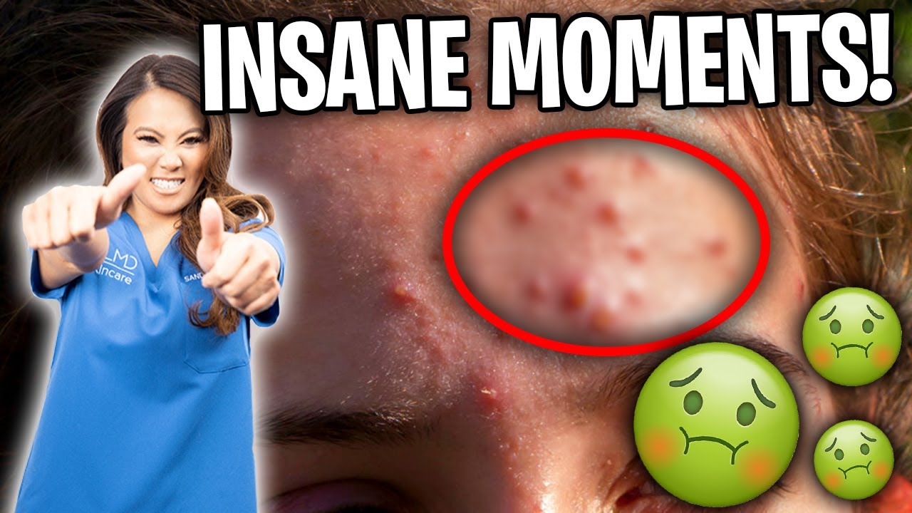8 of the MOST INSANE Moments on Dr. Pimple Popper! (Part 12) - YouTube
