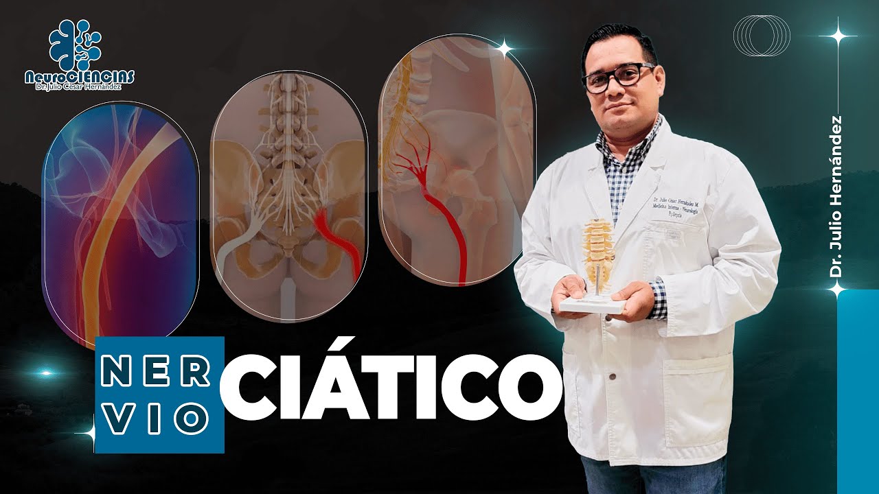 ¿Qué es el Nervio Ciático? | Neurólogo explica - YouTube