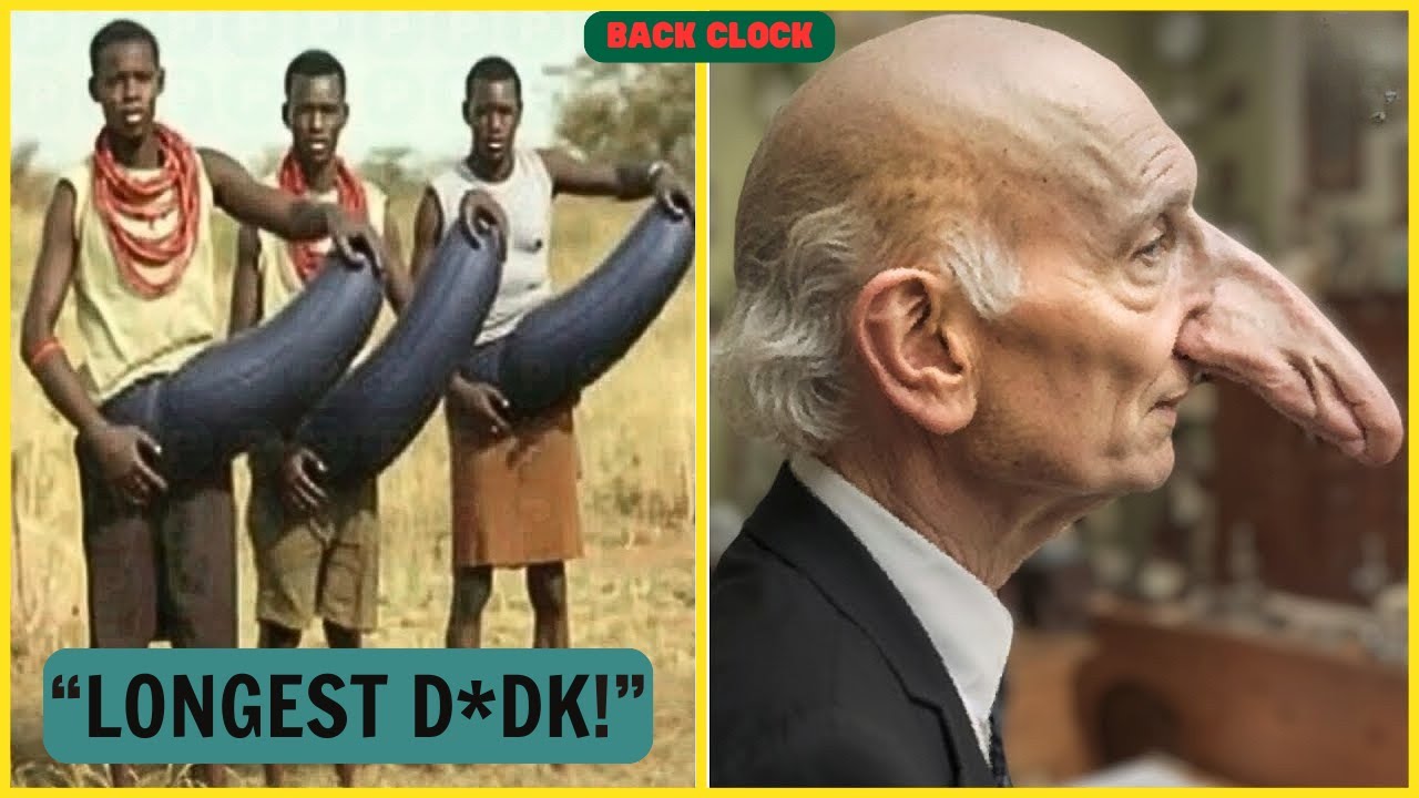 Top 25 People With Bigger Than Normal Body Parts | Then and Now 2025 ...