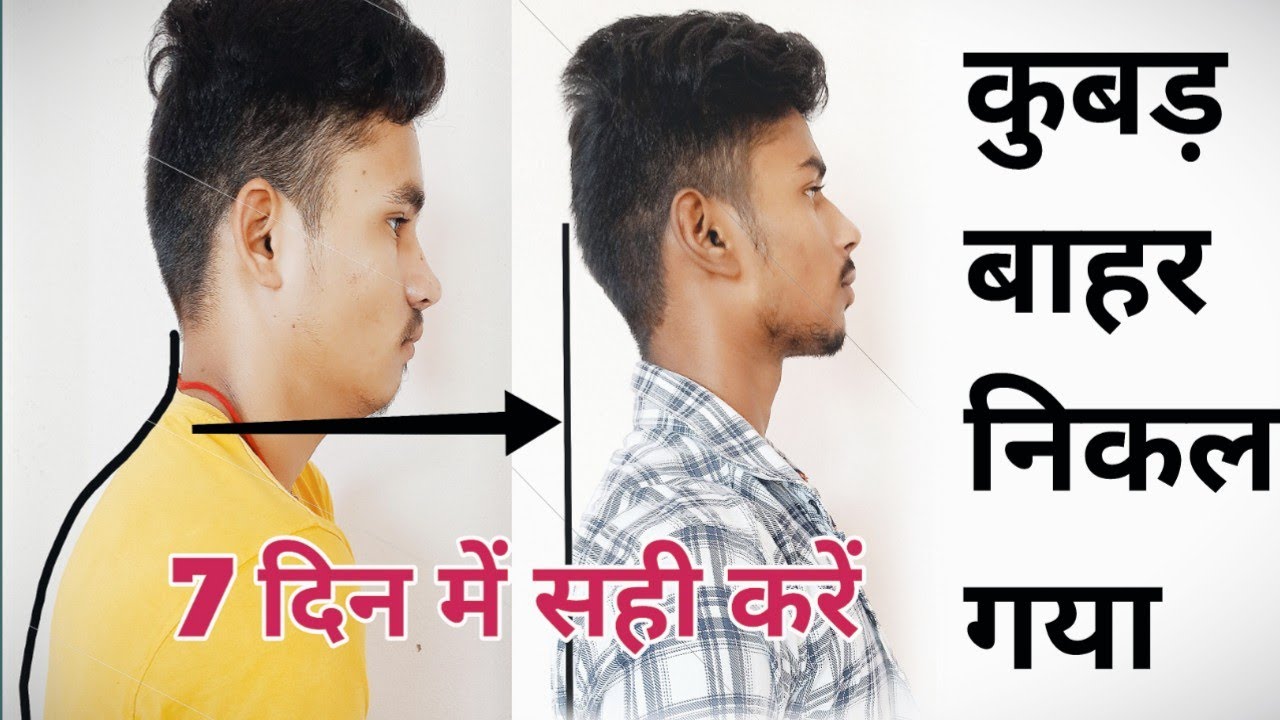 kubadpan thik karne ke liye exercise |How to improve back posture ...