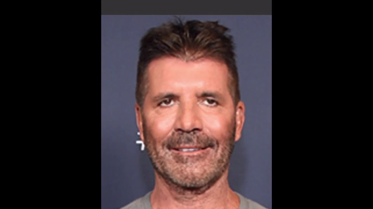 Simon Cowell| Botched Face ?! - YouTube