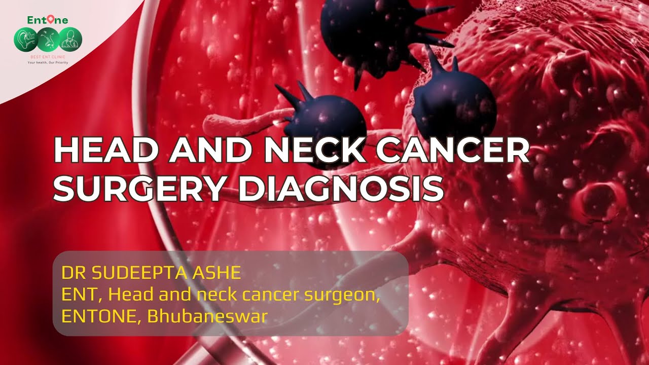 ENT Head and neck cancer diagnosis before surgery, #Cancer # ...