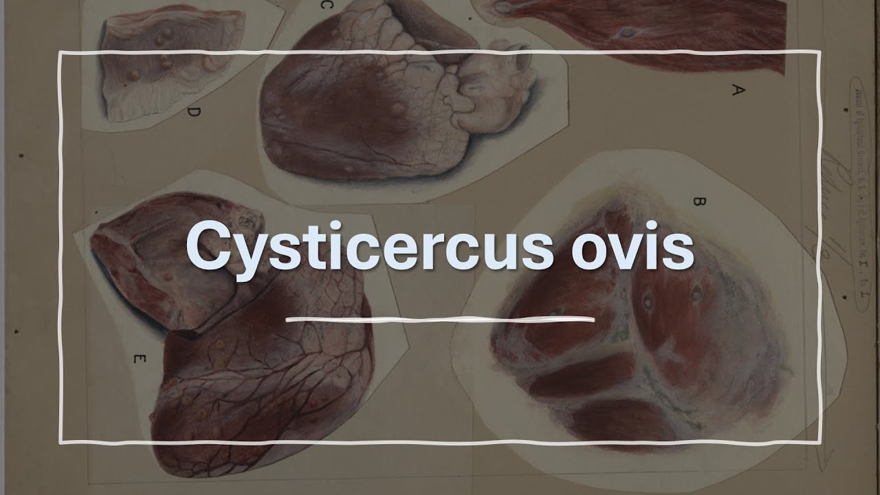 Lecture 53: Cysticercus ovis الكيسَةُ المُذَنَّبَةُ الغَنَمِيَّة - YouTube