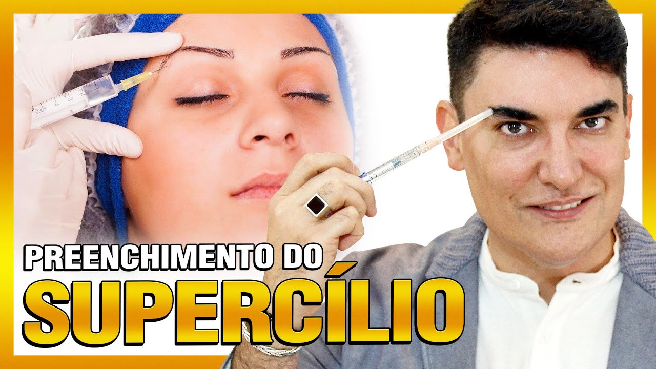 “HARMONIZAÇÃO FACIAL”: PREENCHIMENTO DO SUPERCÍLIO | Tudo o que você ...