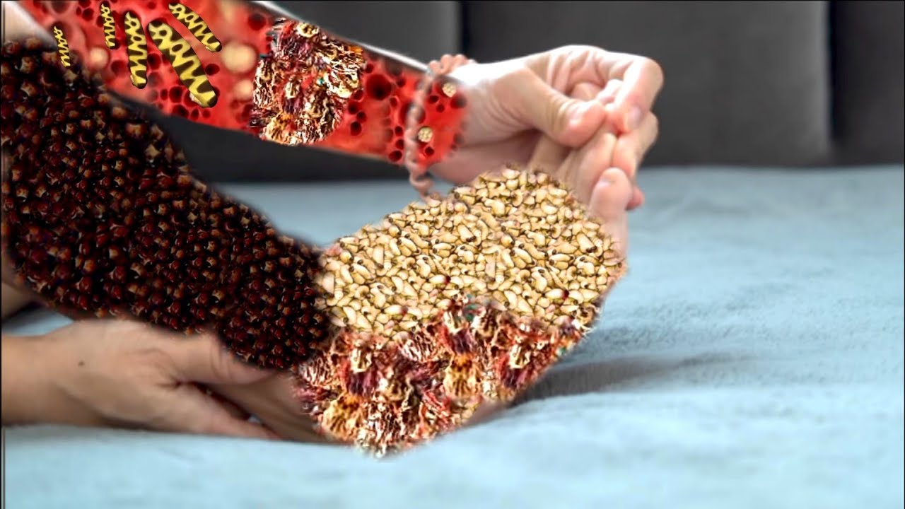 😭 ASMR Foot Surgery Treatment Urgent | ASMR Severely Infected Maggot ...