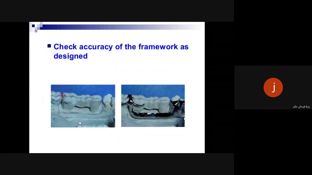 trial insertion of metal framework - lec6 - YouTube