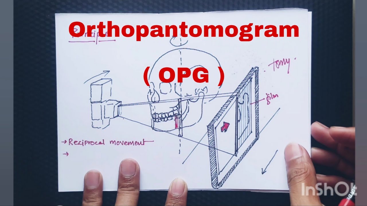 Orthopantomogram ( OPG ) Part 1 ( Hindi ) Principles, Focal Trough ...