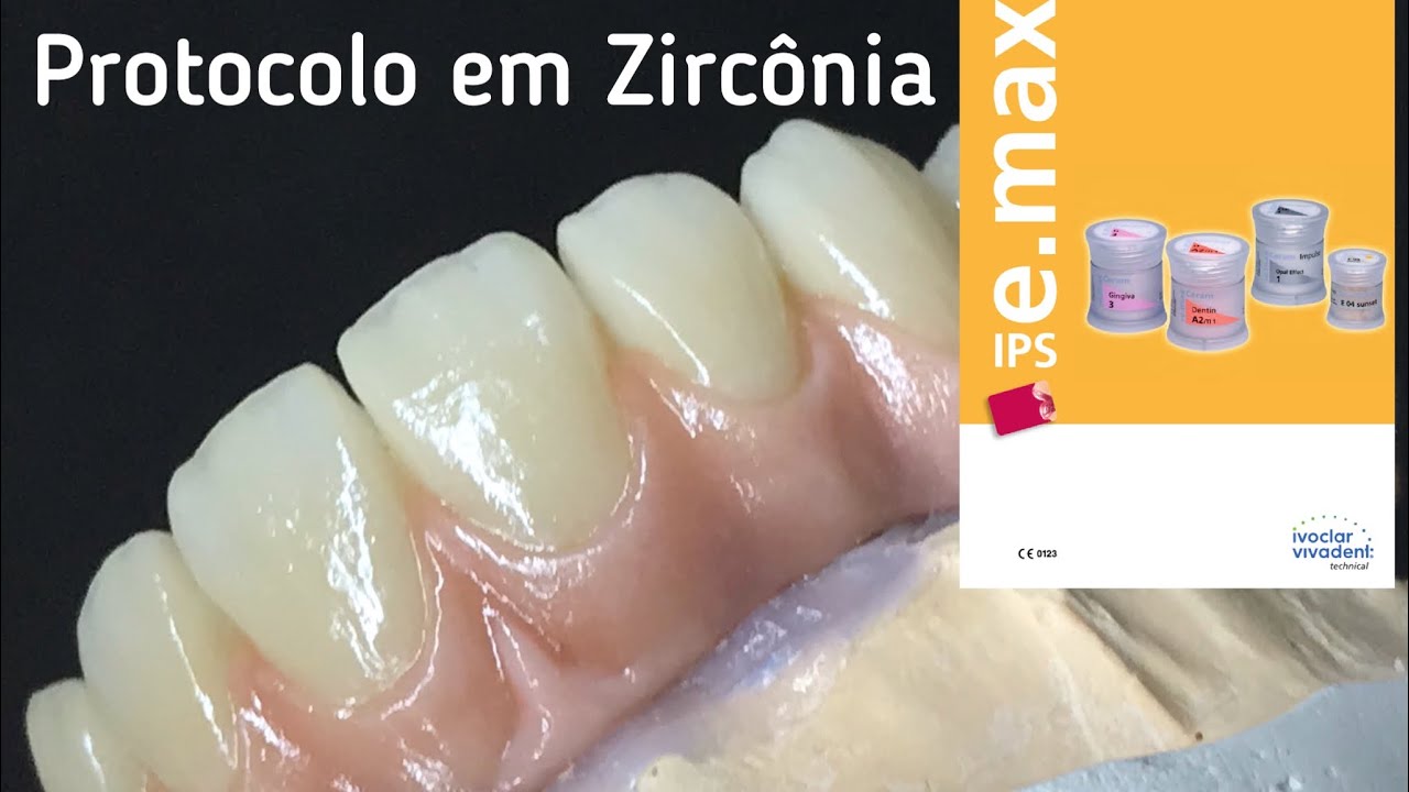 Protocolo em zircônia com redução vestibular para estratificação - YouTube