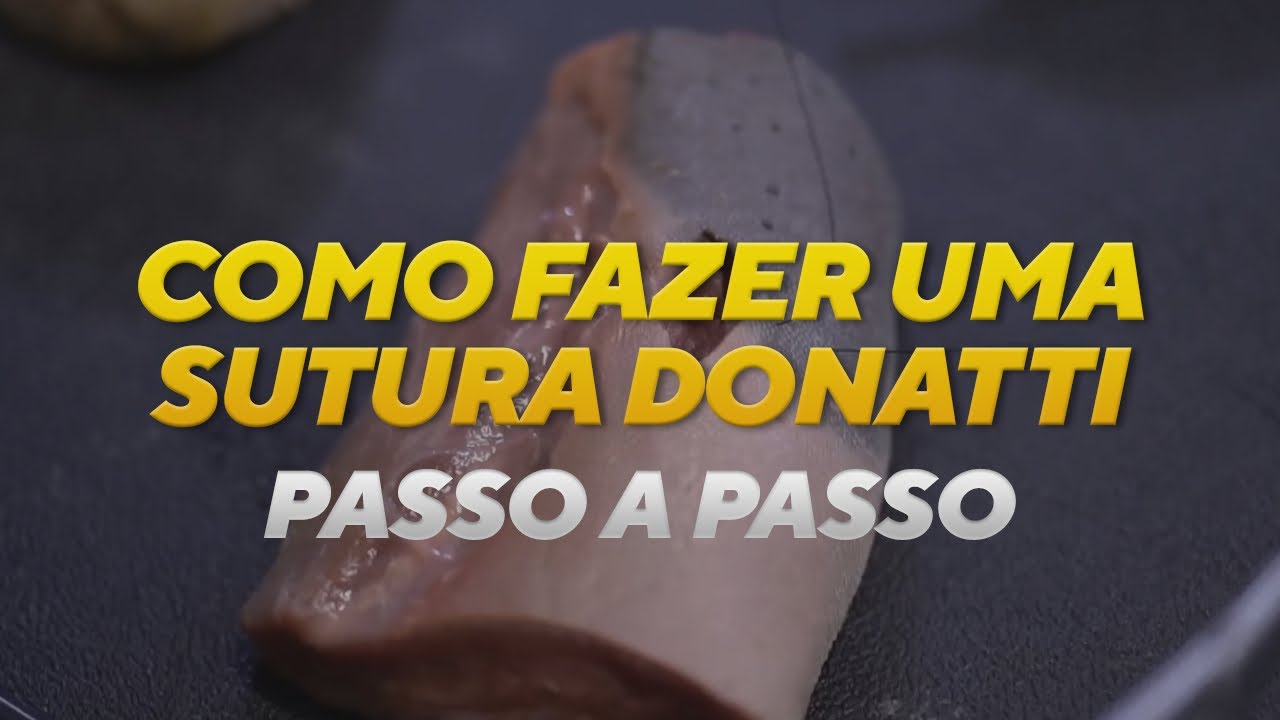 Como fazer a sutura Donatti ou colchoeiro vertical. Passo a passo ...