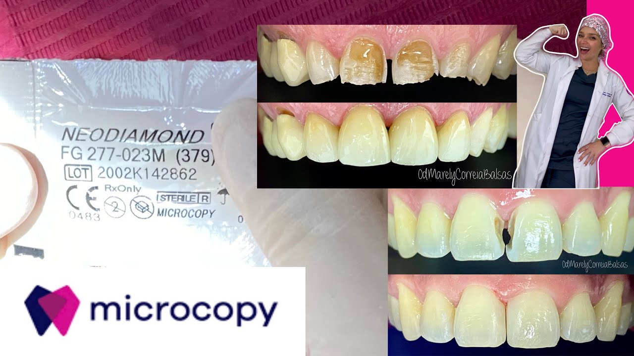 Como usar las FRESAS DENTALES ??! Colaboración con MICROCOPY DENTAL ...