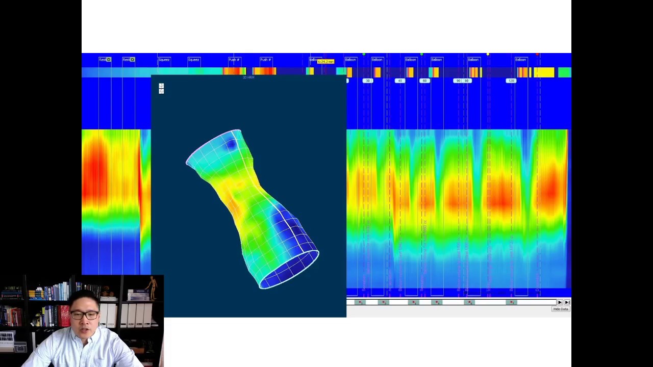 Quick Talk - Colonic and Anorectal Manometry in Children - YouTube