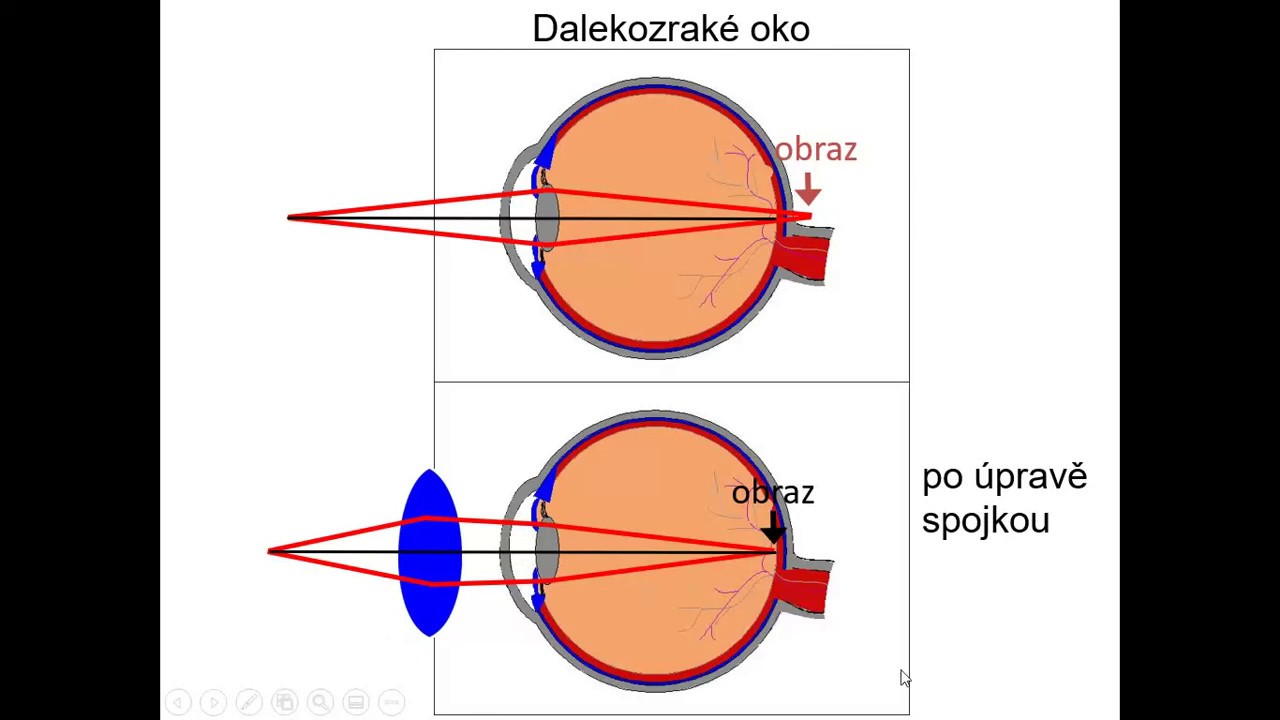 F7 - Optické vlastnosti oka, vady zraku - YouTube