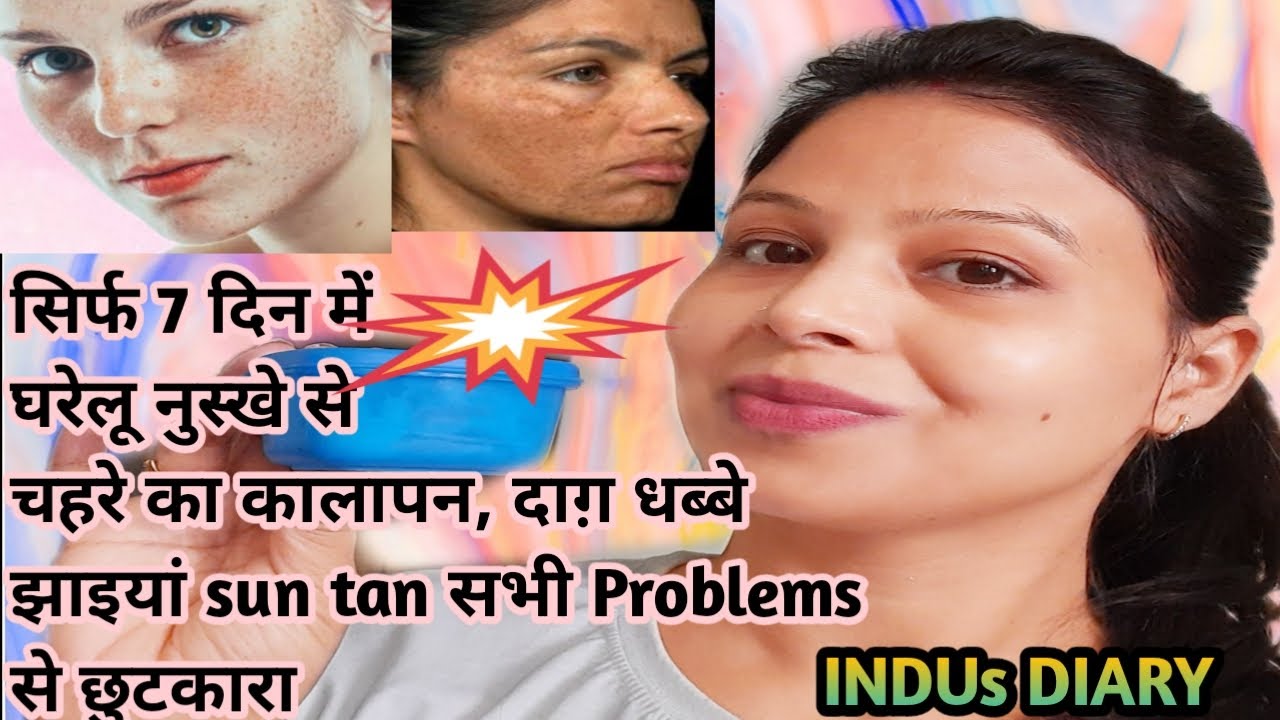 सिर्फ 7 दिनमें Pigmentation SunTan Darkness सभी Problems से छुटकारा ...