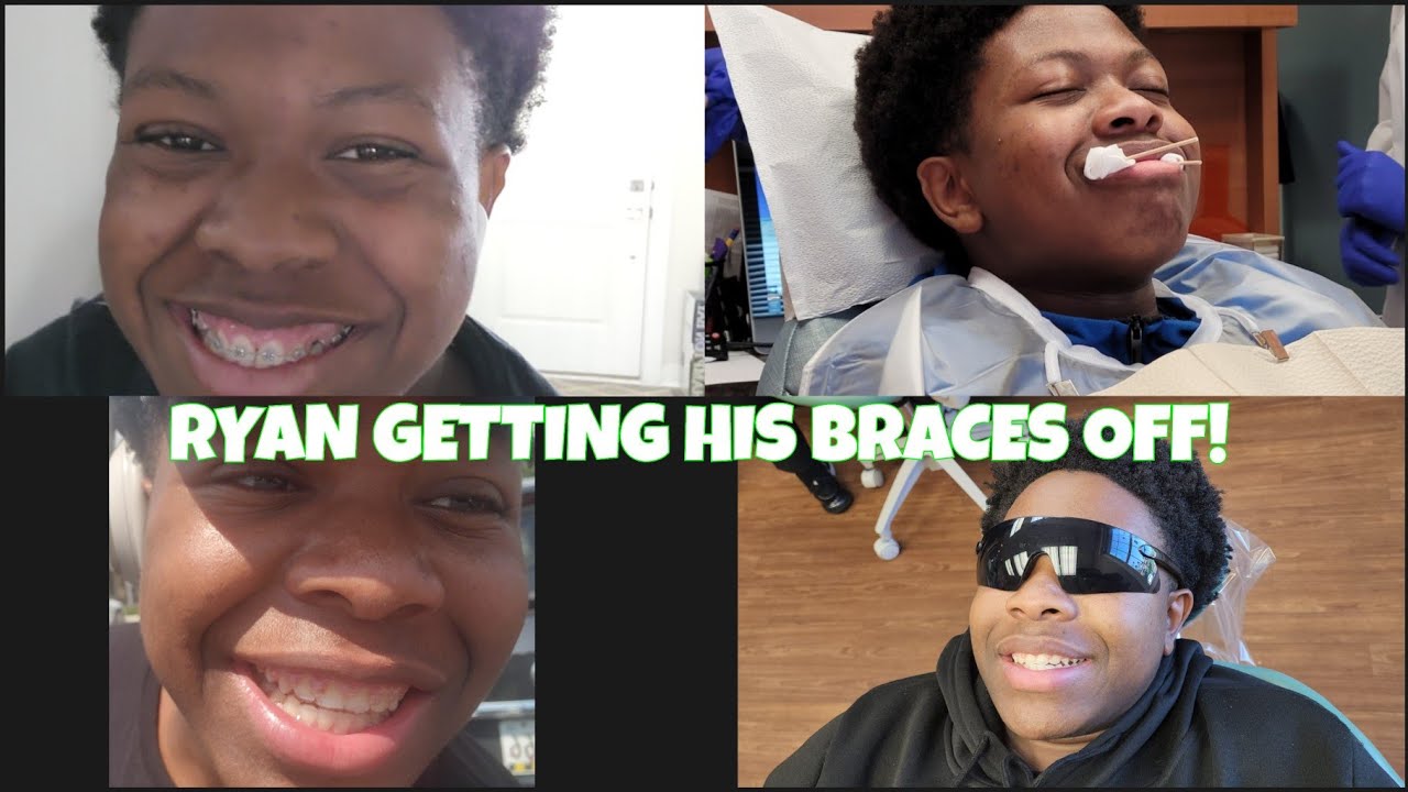 RYAN GETTING HIS BRACES OFF! - YouTube