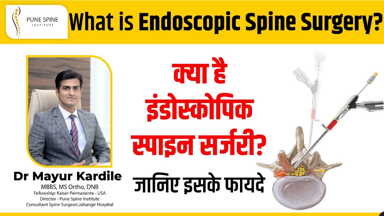 What is Endoscopic Spine Surgery क्या है इंडोस्कोपिक स्पाइन सर्जरी ...