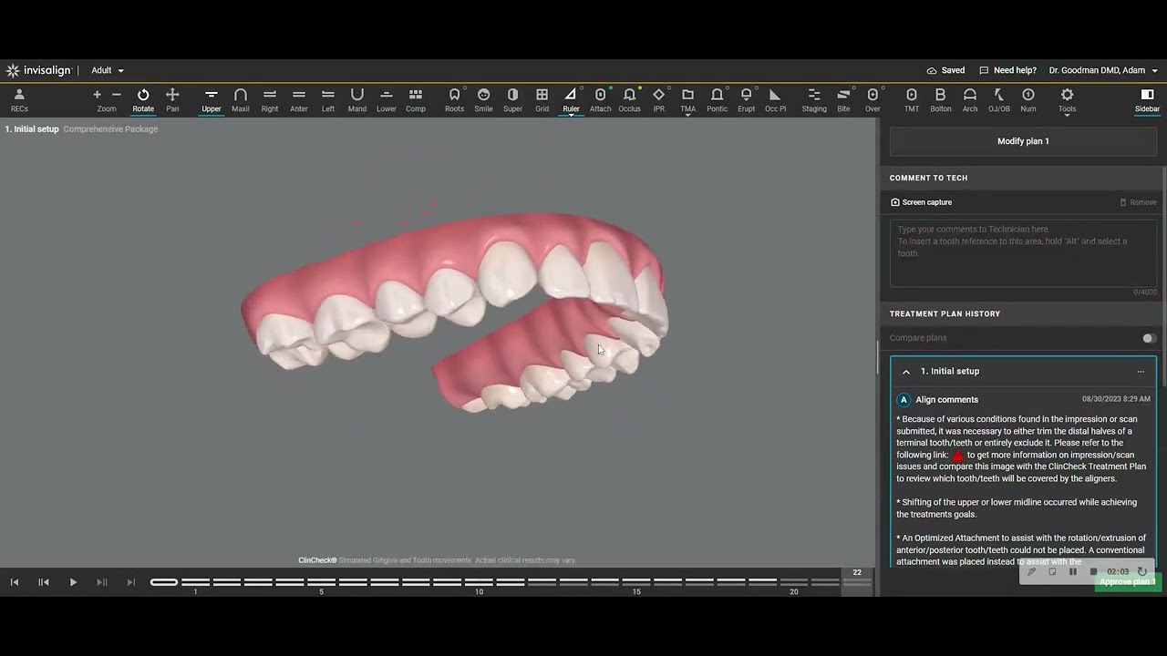 Very common mistake with clincheck design in Invisalign treatment ...
