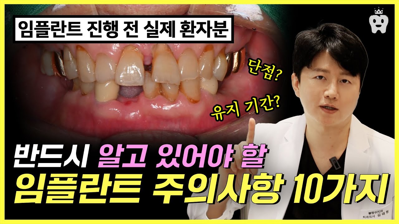 임플란트 전 반드시 알아야 할 10가지 사실 Youtube