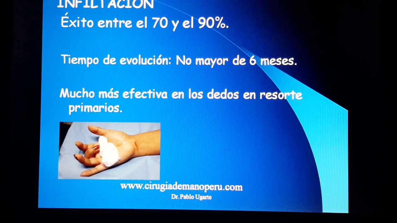 Dedo en gatillo, Dedo en resorte Dr.Pablo Ugarte, - YouTube