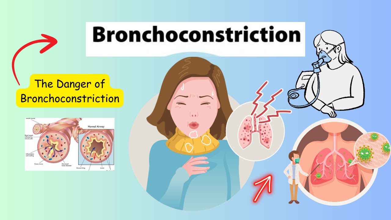 Bronchoconstriction Care and Management - YouTube