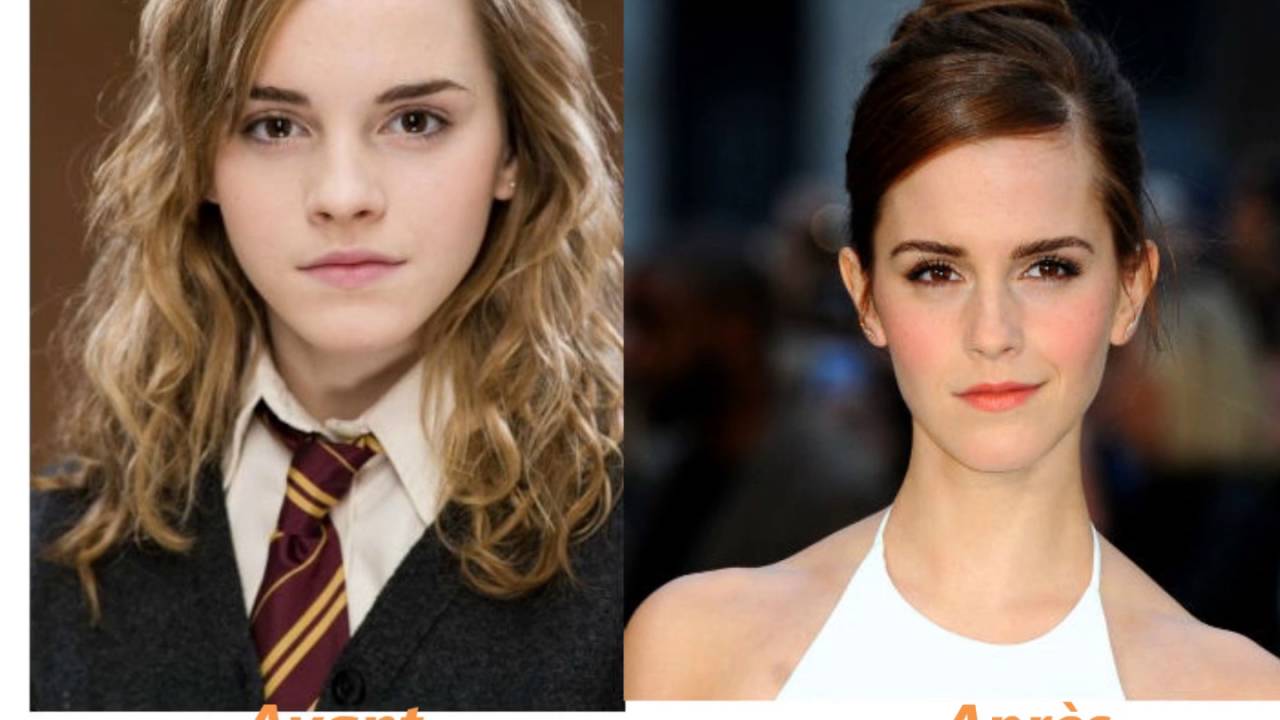 Avant/Après de star connu. - YouTube