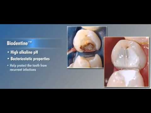 Henry Schein UK - Biodentine® from Septodont - Dentin in a Capsule ...