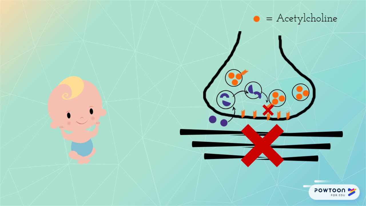 Infant Botulism and Botulinum Toxin MOA - YouTube