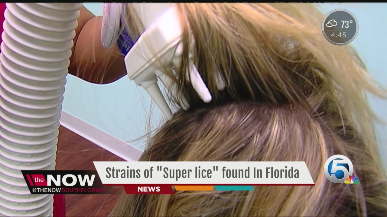 Strains of 'Super lice' found in Florida - YouTube